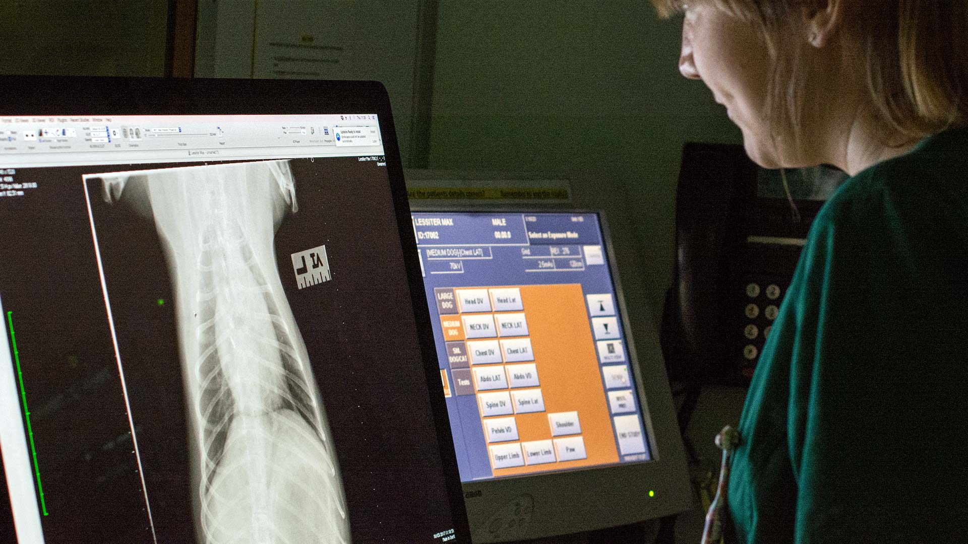 What Does X Ray Mean On Prime What Does X Ray Mean On Prime
